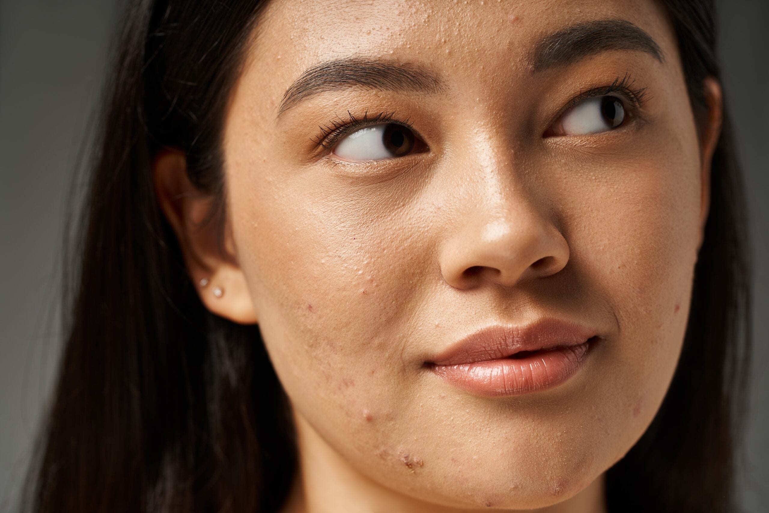 Compromised Skin Barrier: Signs & How to Restore It | Science Skincare